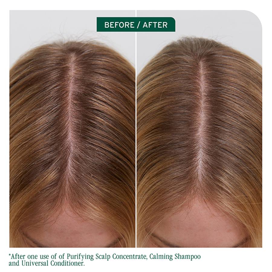 Biolage Scalp Sync Clarifying Shampoo 400ml – Salon Supplies